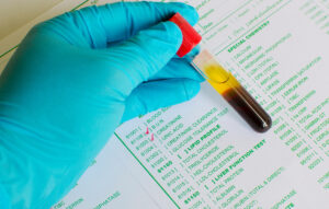 Kidney Function Tests Overview | What You Need to Know