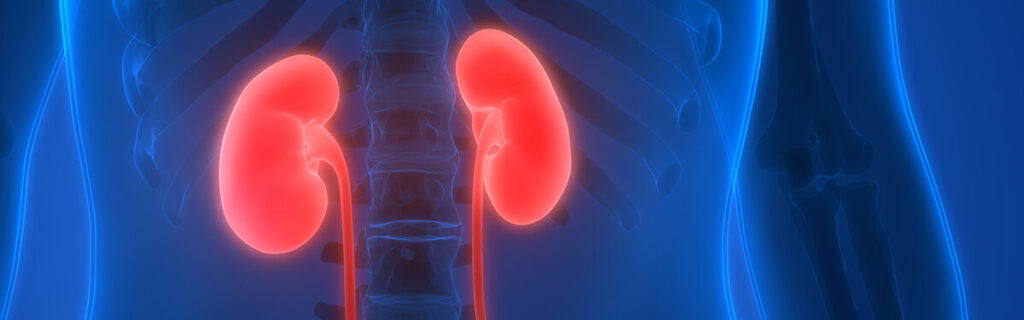 Research in Kidney Health and Disease - Midwest Nephrology Consultants